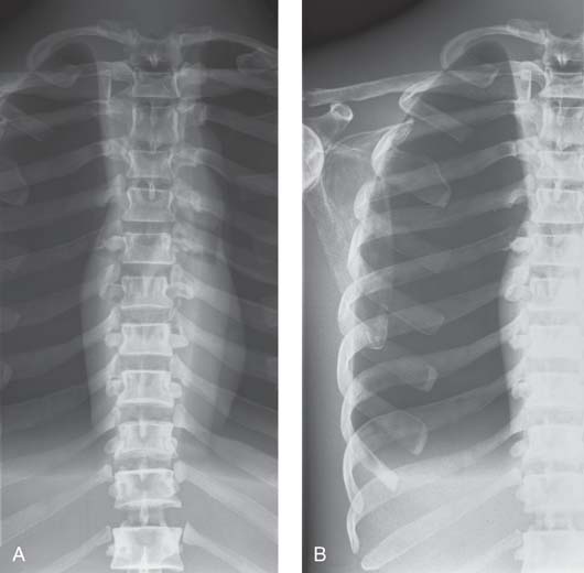 Radiographic Imaging and Exposure