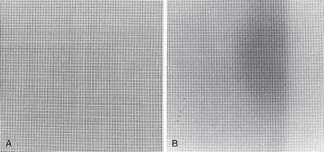Radiographic Imaging and Exposure