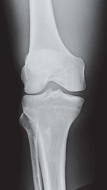 Radiographic Imaging and Exposure