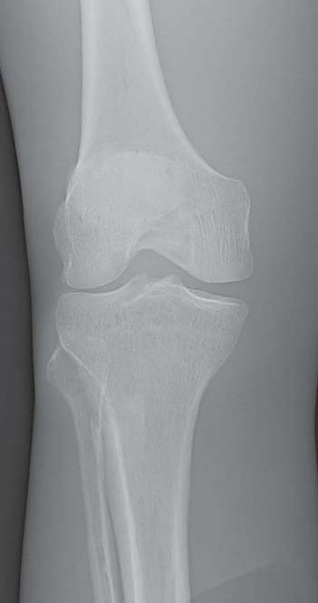 Radiographic Imaging and Exposure