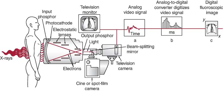 Radiographic Imaging and Exposure