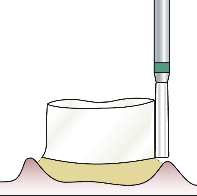 Dental Instruments