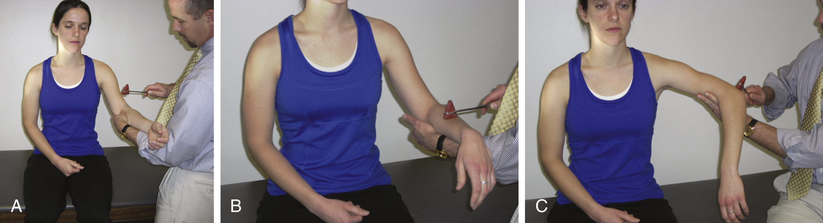 Rehabilitation of the Hand and Upper Extremity