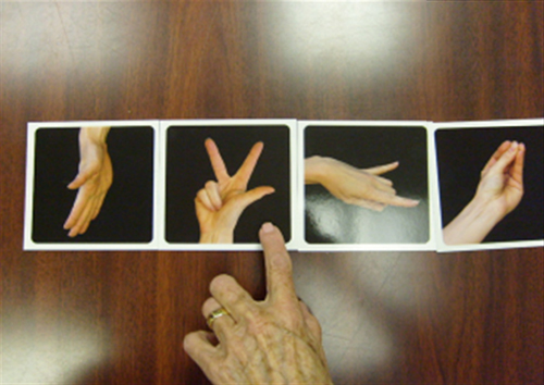 Rehabilitation of the Hand and Upper Extremity