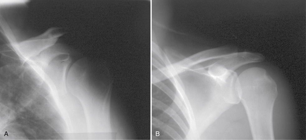Preliminary Steps in Radiography