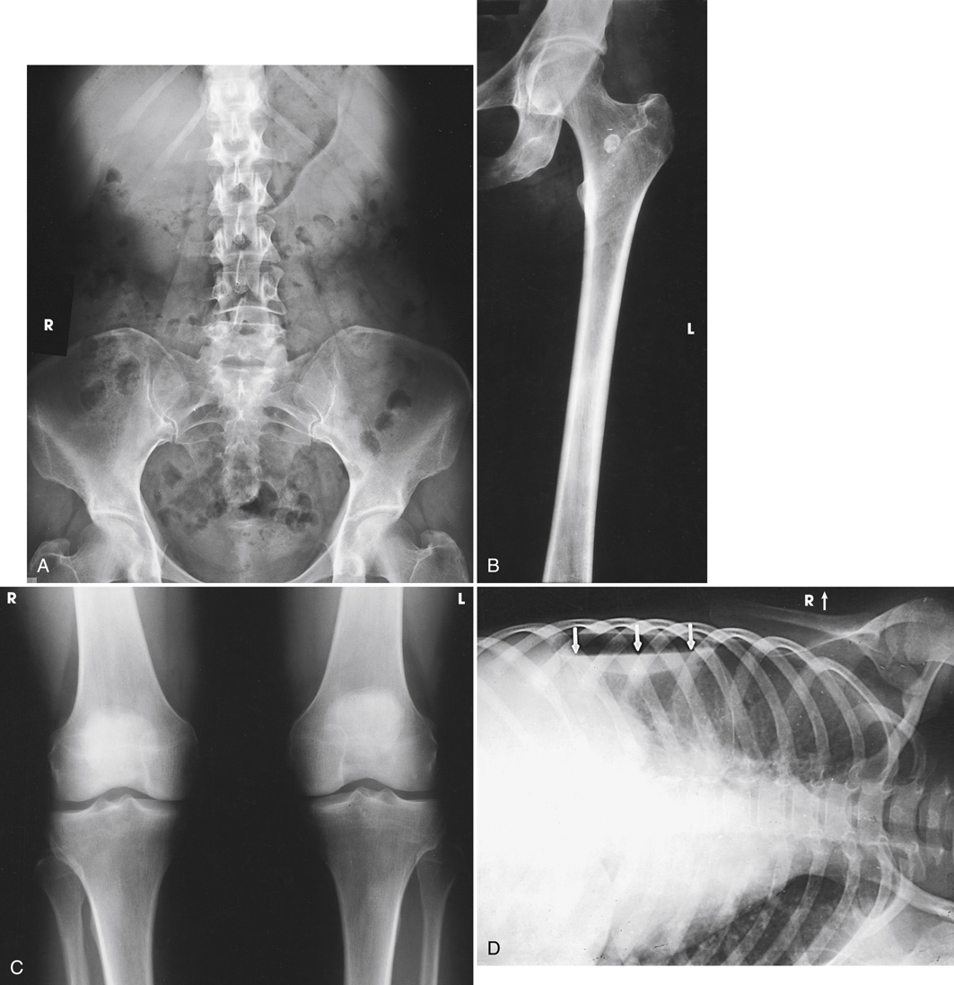 Preliminary Steps in Radiography