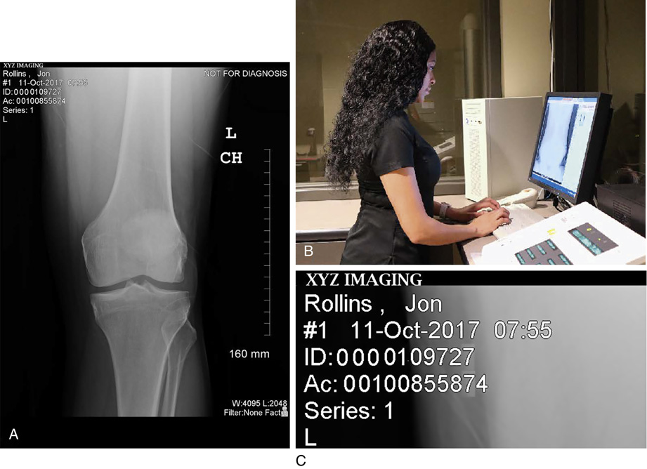Preliminary Steps in Radiography