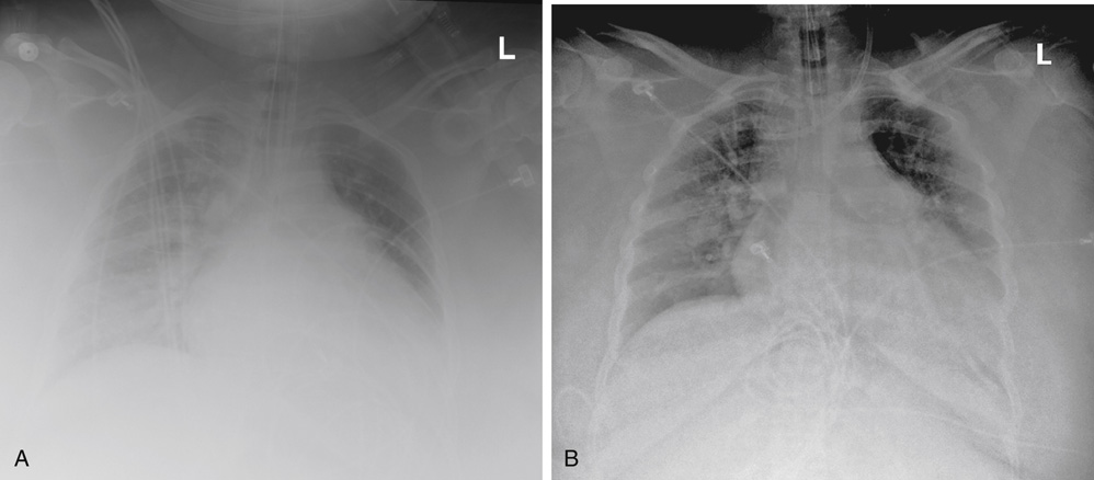 Preliminary Steps in Radiography