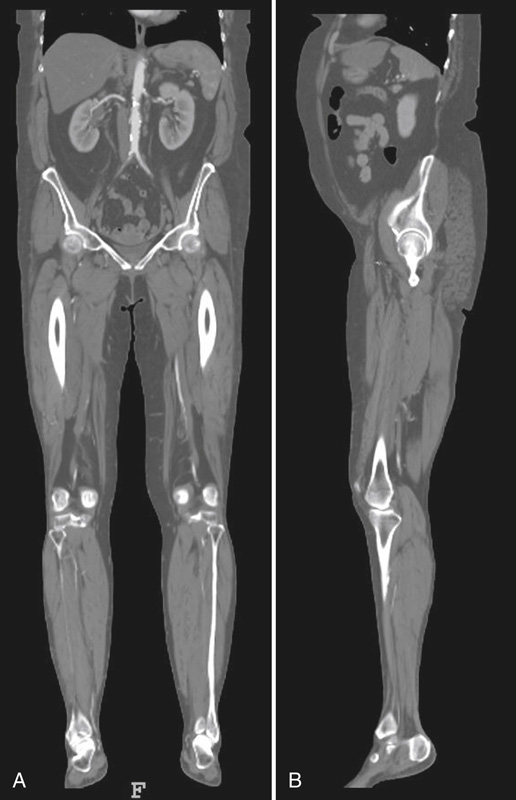 General Anatomy and Radiographic Positioning Terminology