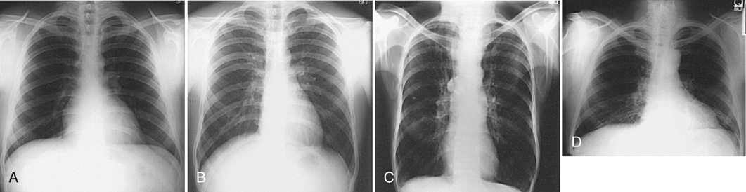 General Anatomy and Radiographic Positioning Terminology