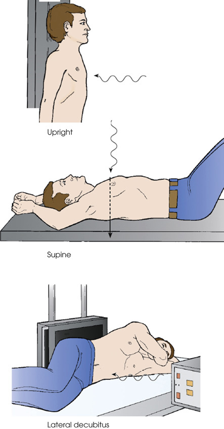 General Anatomy and Radiographic Positioning Terminology