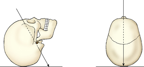 General Anatomy and Radiographic Positioning Terminology