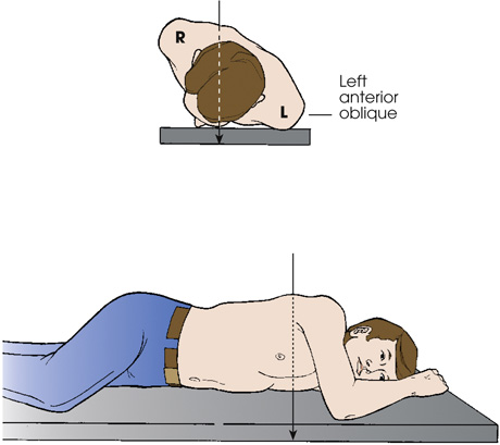 General Anatomy and Radiographic Positioning Terminology