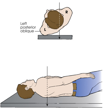 General Anatomy and Radiographic Positioning Terminology
