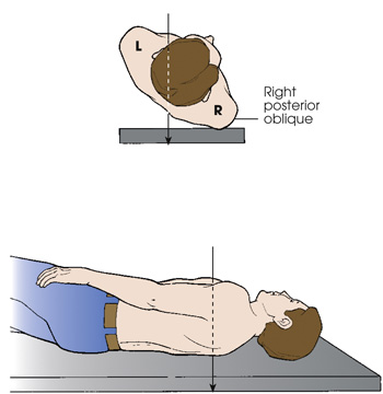 General Anatomy and Radiographic Positioning Terminology