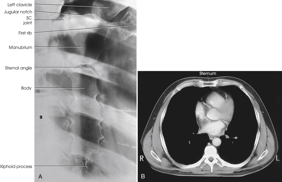 Bony Thorax