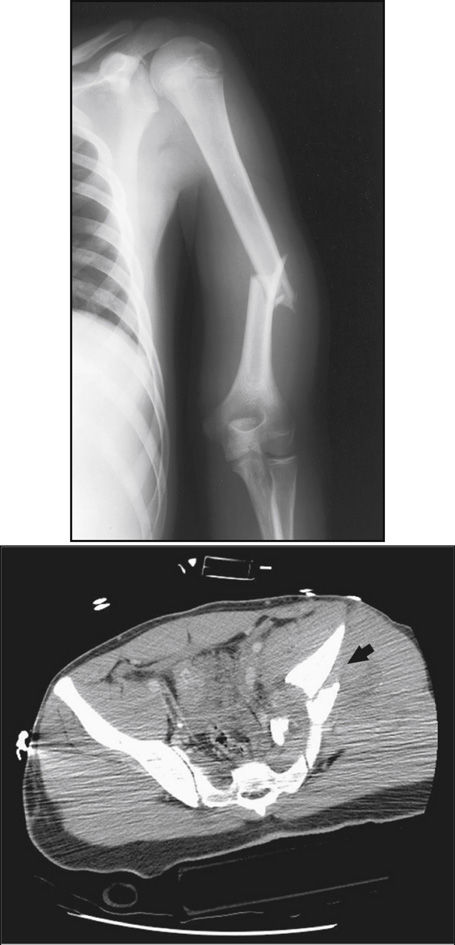 Trauma Radiography