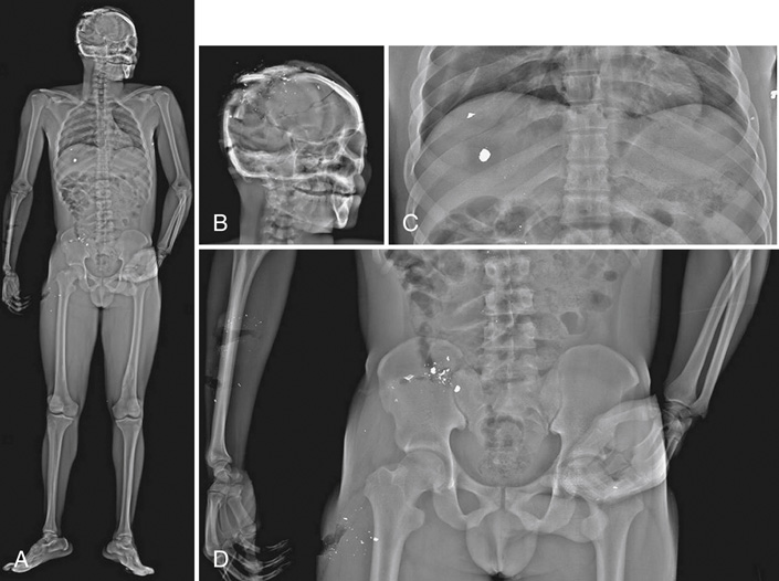 Trauma Radiography