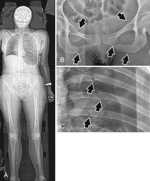 Trauma Radiography