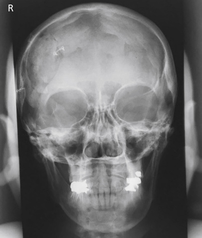 Trauma Radiography