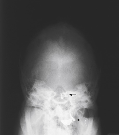 Trauma Radiography
