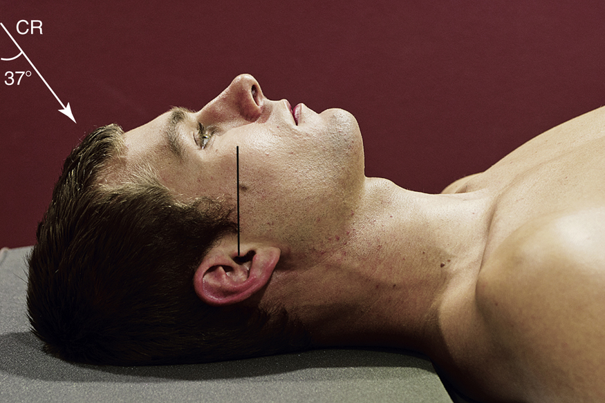 Bontrager's Textbook of Radiographic Positioning and Related Anatomy