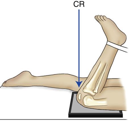 Bontrager's Textbook of Radiographic Positioning and Related Anatomy