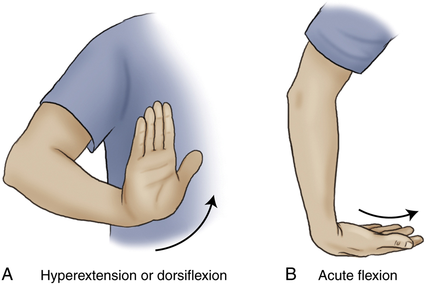 Bontrager's Textbook of Radiographic Positioning and Related Anatomy