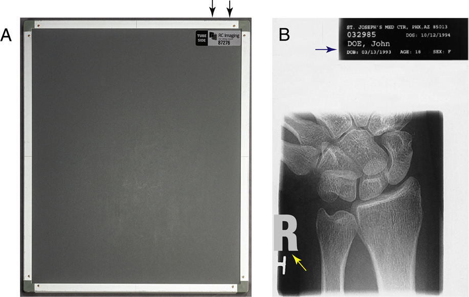 Bontrager's Textbook of Radiographic Positioning and Related Anatomy