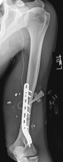 Bontrager's Textbook of Radiographic Positioning and Related Anatomy