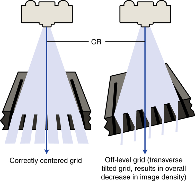 Bontrager's Textbook of Radiographic Positioning and Related Anatomy