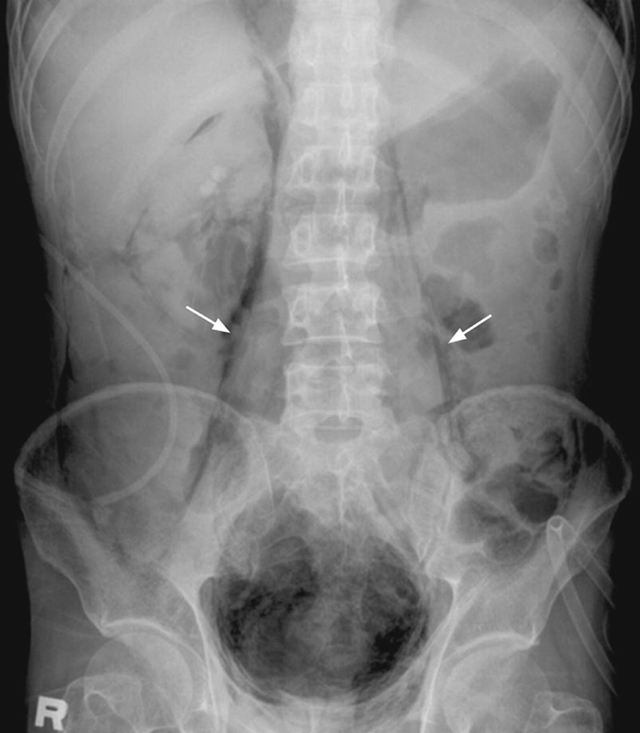 Bontrager's Textbook of Radiographic Positioning and Related Anatomy