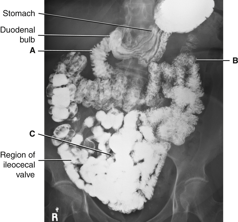 Bontrager's Textbook of Radiographic Positioning and Related Anatomy