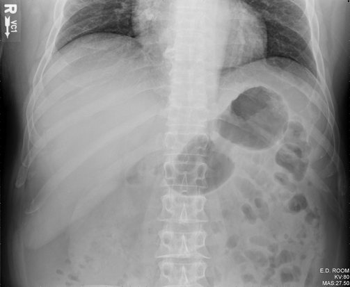 Bontrager's Textbook of Radiographic Positioning and Related Anatomy
