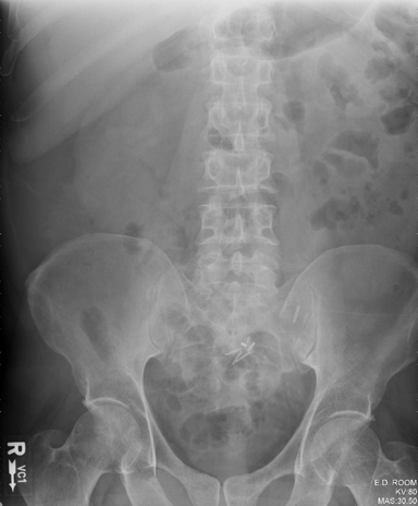 Bontrager's Textbook of Radiographic Positioning and Related Anatomy