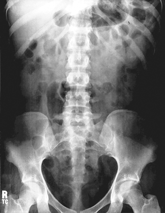 Bontrager's Textbook of Radiographic Positioning and Related Anatomy