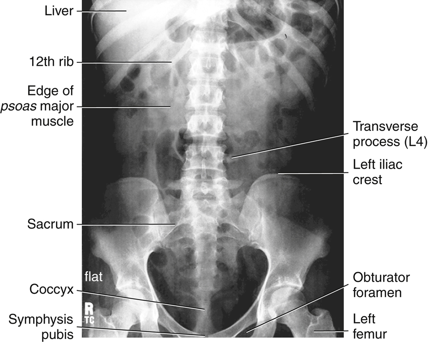 Bontrager's Textbook of Radiographic Positioning and Related Anatomy