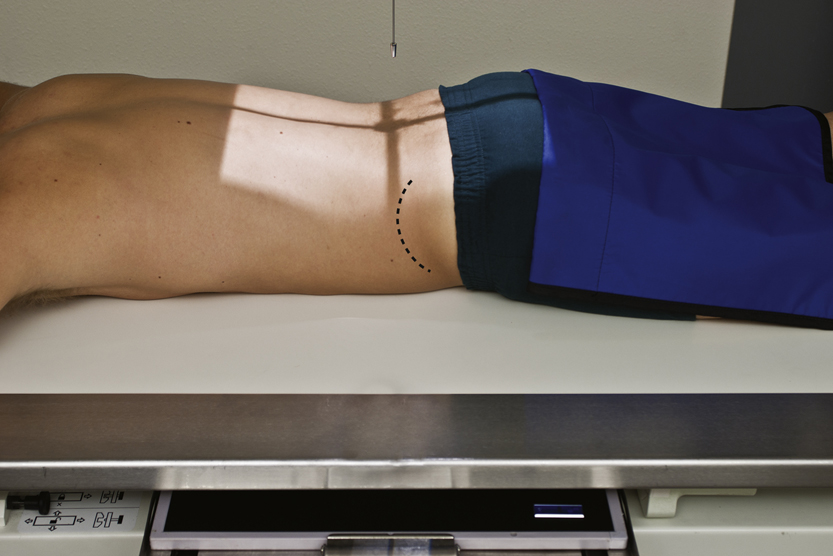 Bontrager's Textbook of Radiographic Positioning and Related Anatomy