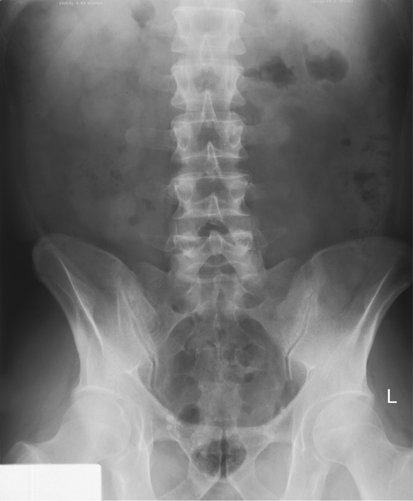 Bontrager's Textbook of Radiographic Positioning and Related Anatomy