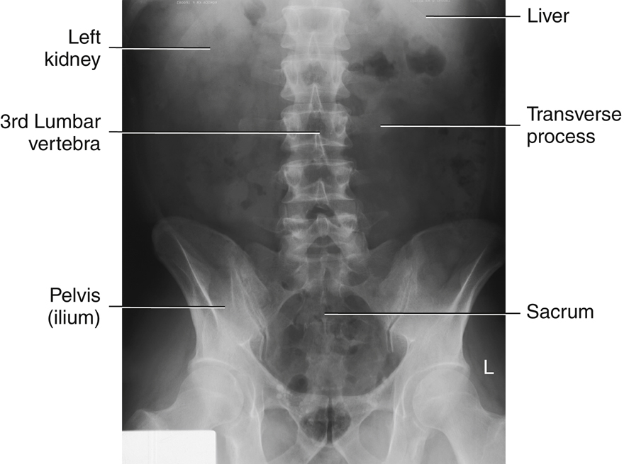Bontrager's Textbook of Radiographic Positioning and Related Anatomy