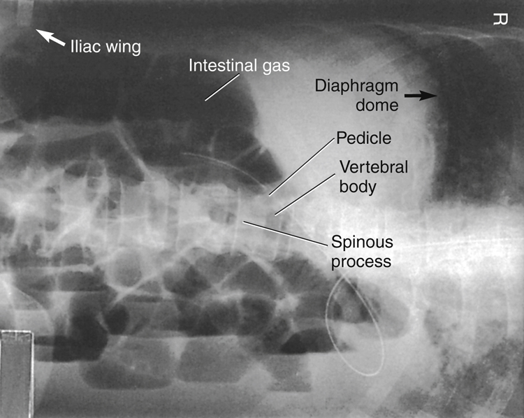 Bontrager's Textbook of Radiographic Positioning and Related Anatomy