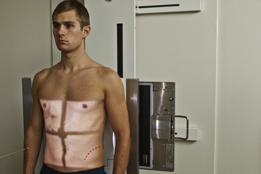 Bontrager's Textbook of Radiographic Positioning and Related Anatomy