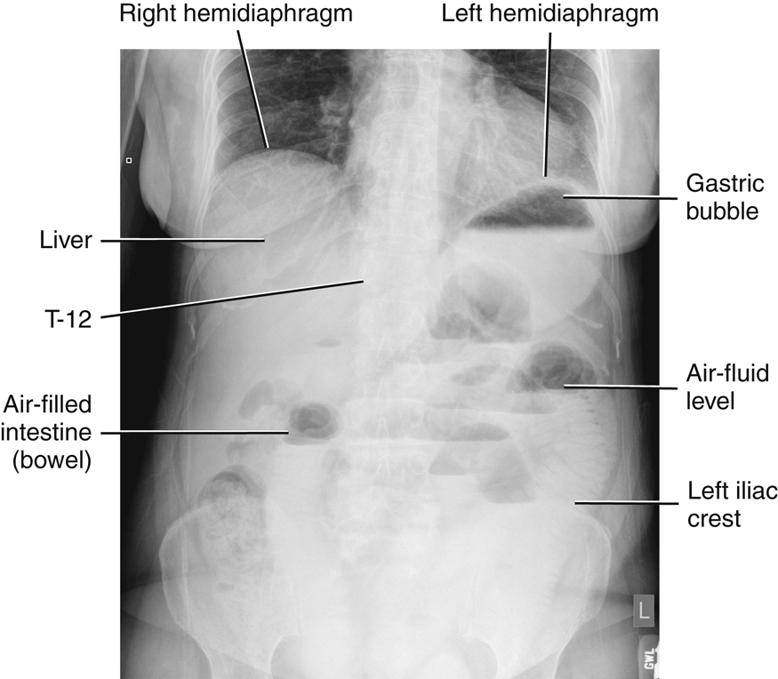 Bontrager's Textbook of Radiographic Positioning and Related Anatomy