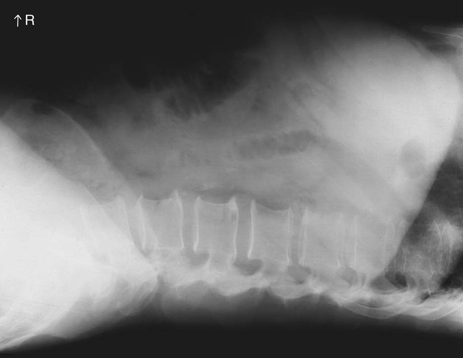 Bontrager's Textbook of Radiographic Positioning and Related Anatomy