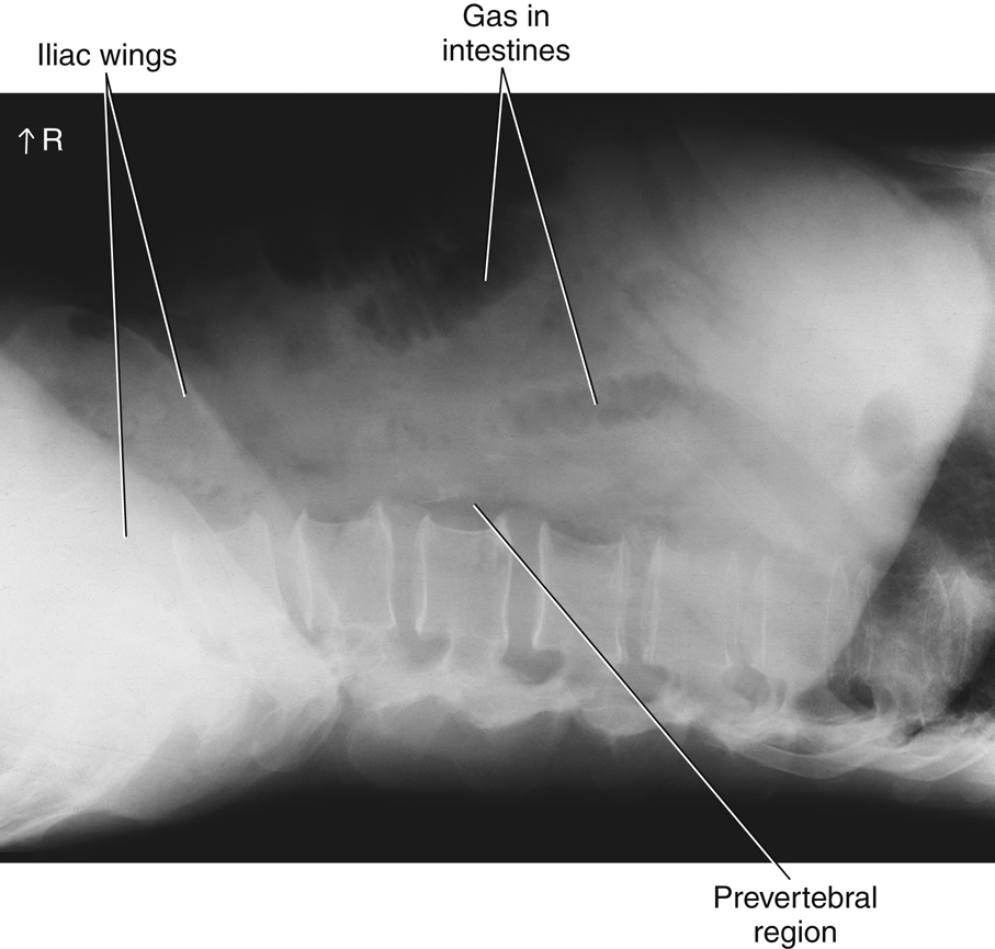 Bontrager's Textbook of Radiographic Positioning and Related Anatomy