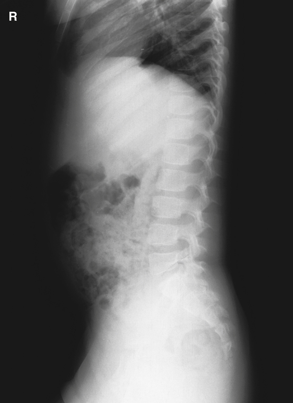 Bontrager's Textbook of Radiographic Positioning and Related Anatomy