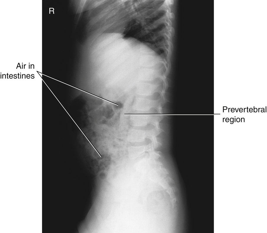Bontrager's Textbook of Radiographic Positioning and Related Anatomy