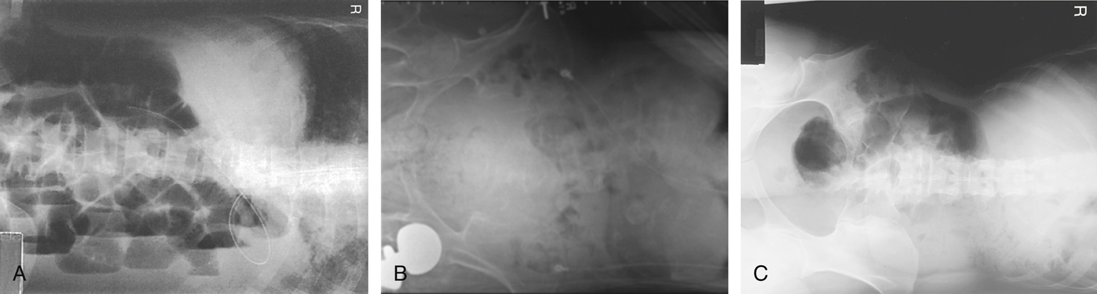 Bontrager's Textbook of Radiographic Positioning and Related Anatomy