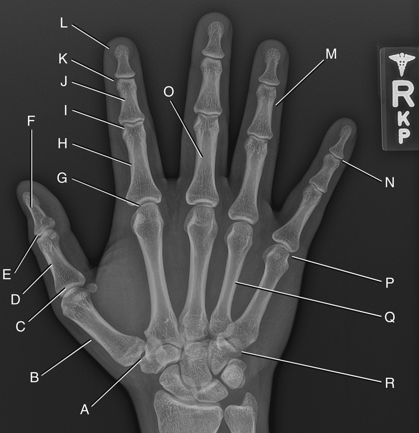 Bontrager's Textbook of Radiographic Positioning and Related Anatomy
