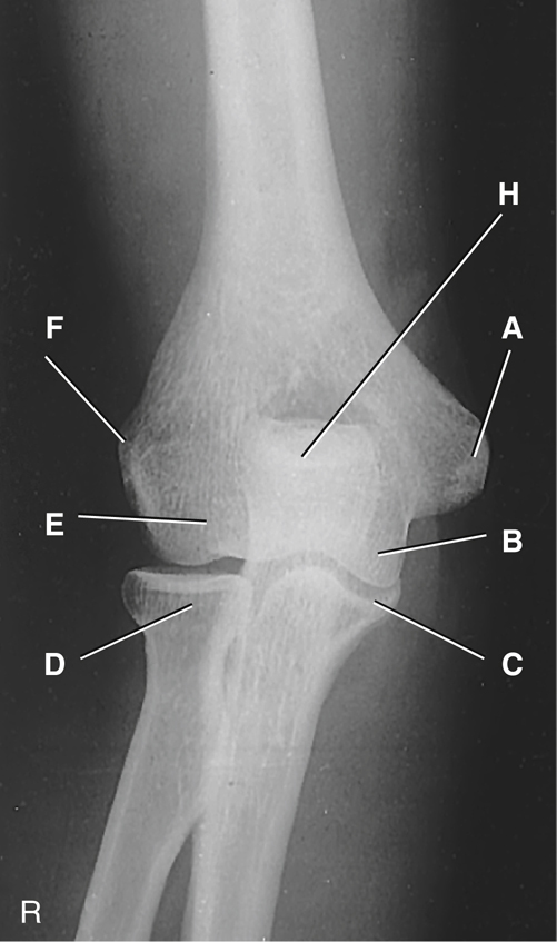 Bontrager's Textbook of Radiographic Positioning and Related Anatomy